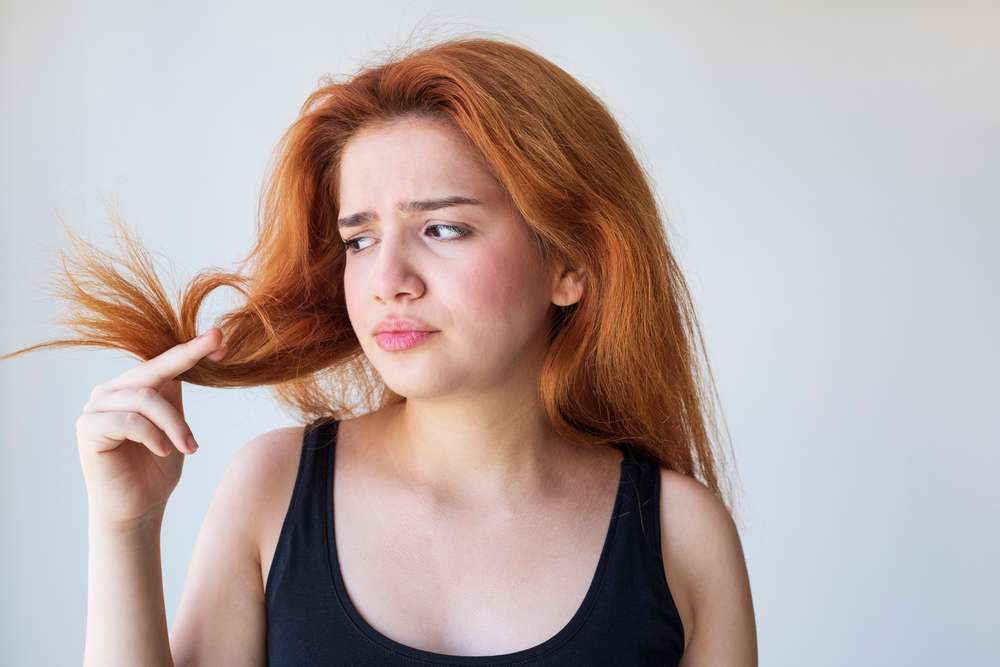 What Causes Dry Brittle Frizzy Hair at Dolores Robertson blog